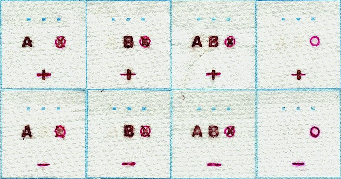 Blood-Typing-Made-Simple