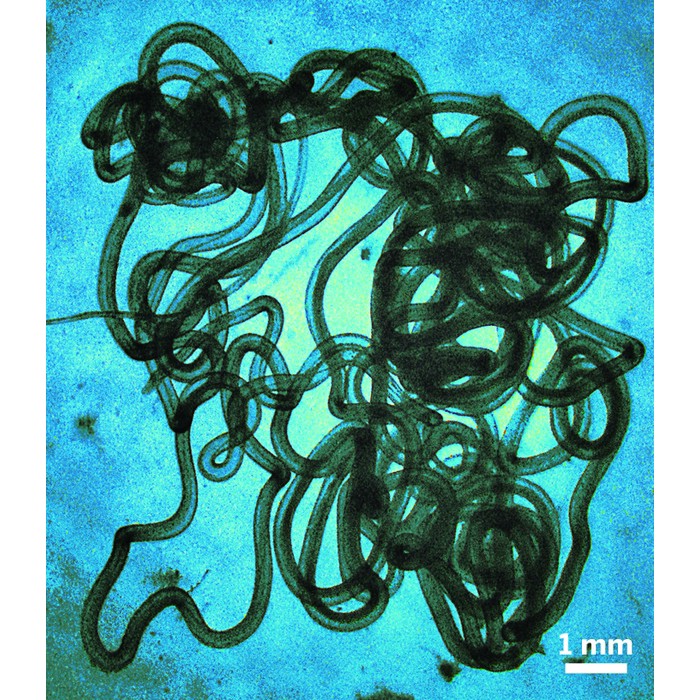 River-Blindness-Marker-Found-Patients