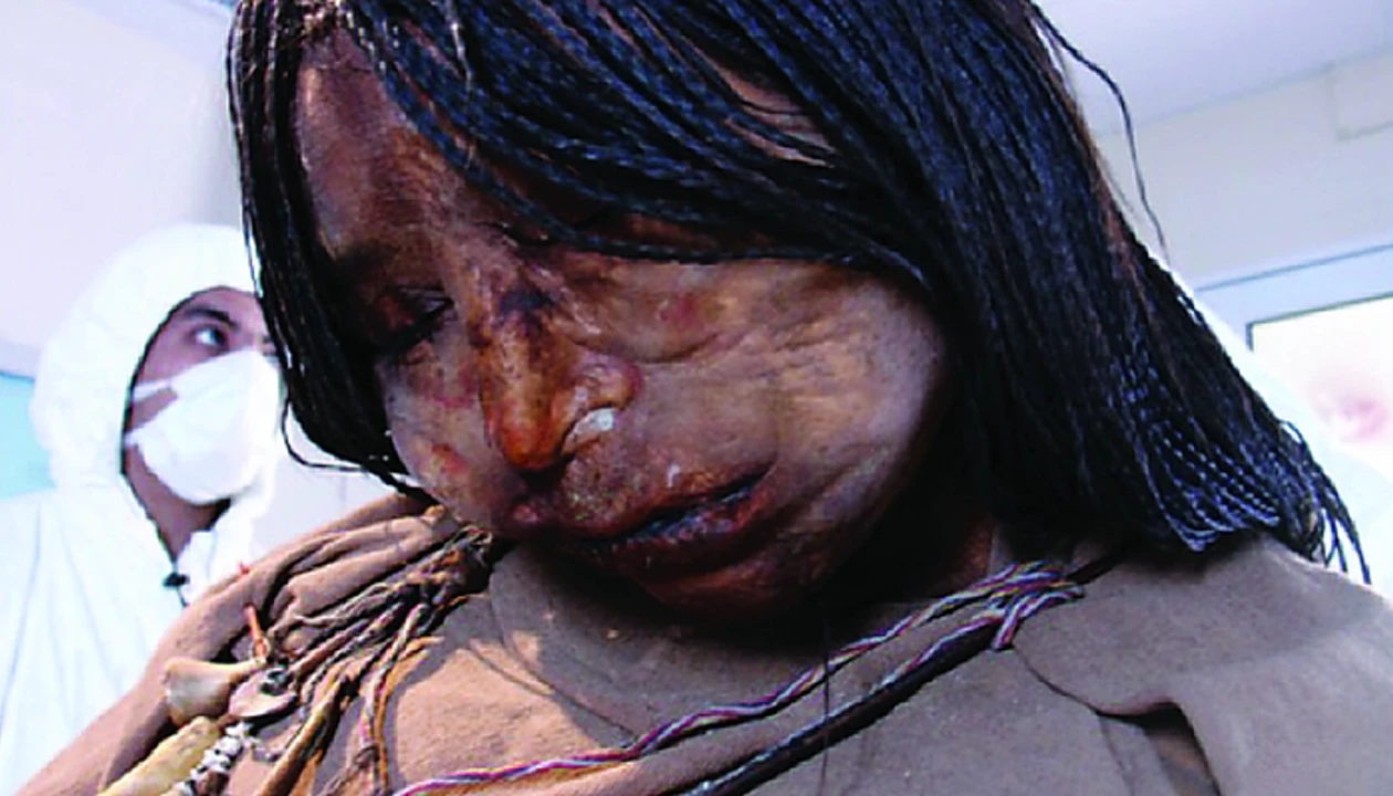 Diagnosing Ancient Disease