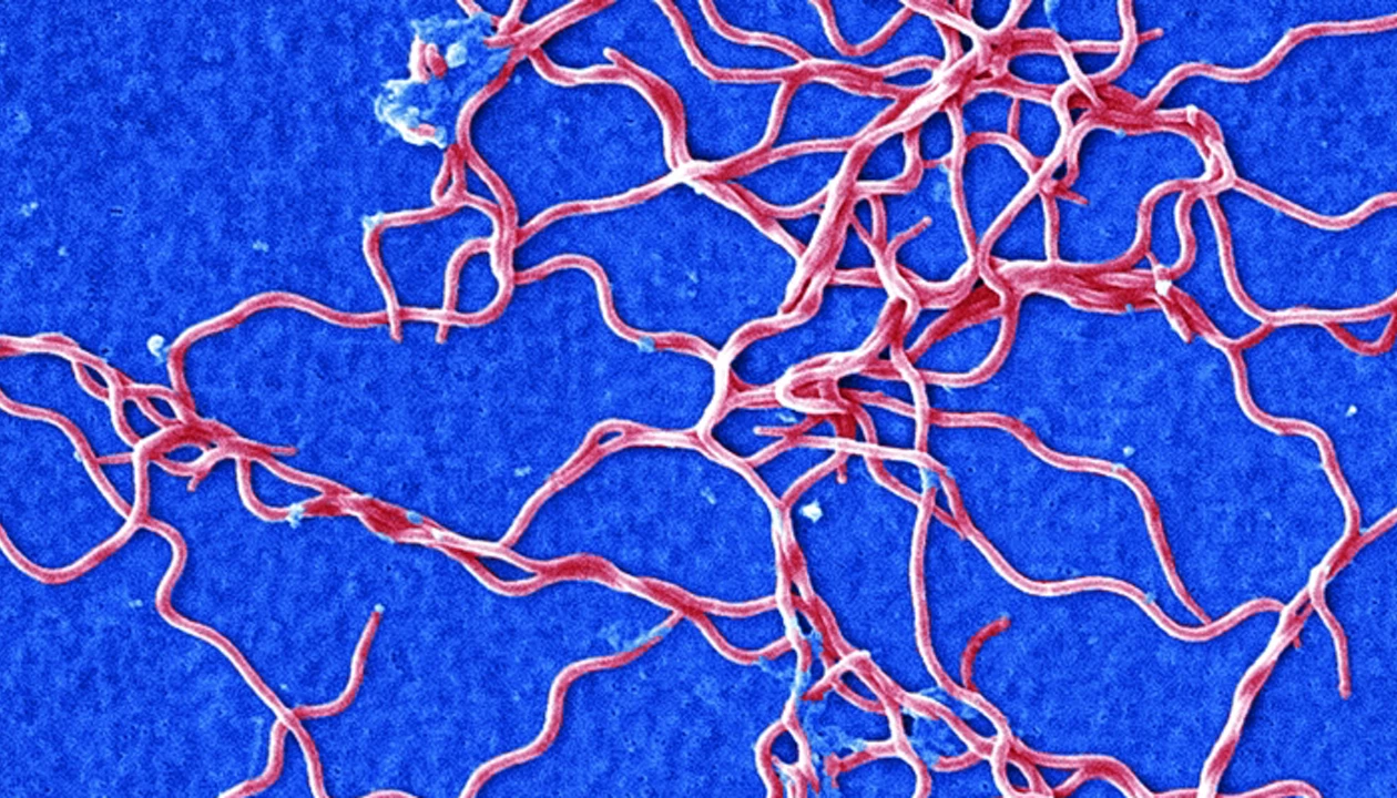 Accelerating Lyme Disease Diagnostics