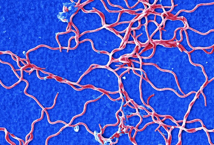 Accelerating-Lyme-Disease-Diagnostics