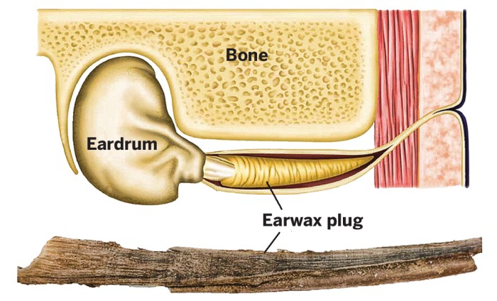 Earwax-Tells-Whale-Story