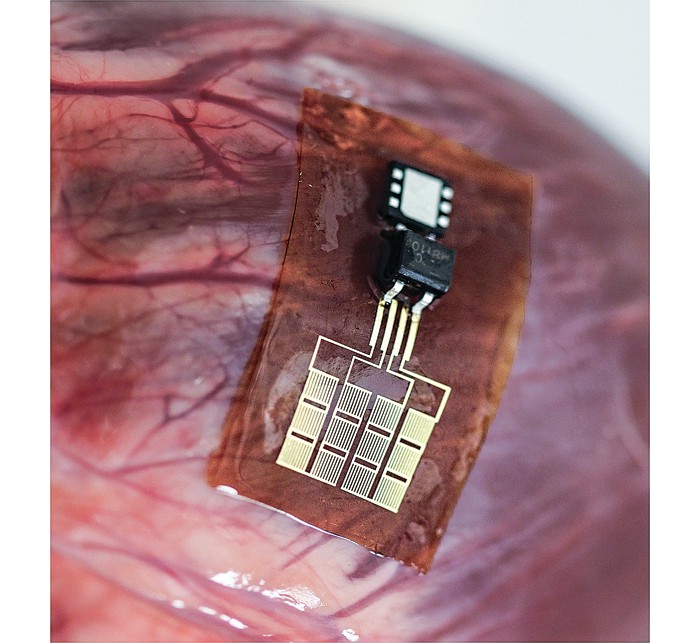 Implants-Powered-Heart