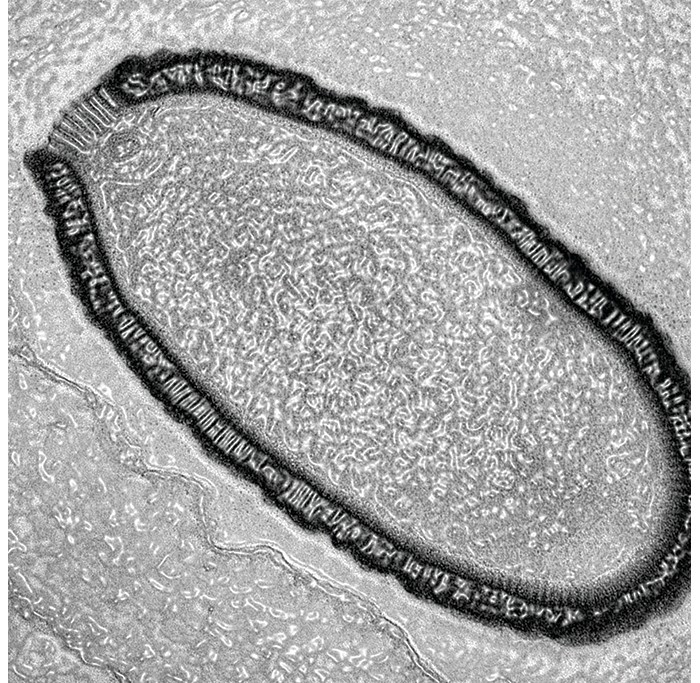 Another-Giant-Virus-Unearthed