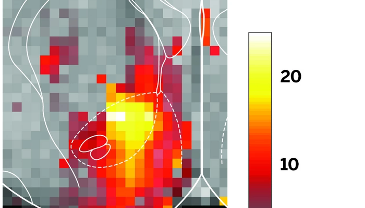 Method Provides 3-D Map Of Dopamine Signaling In The Brain