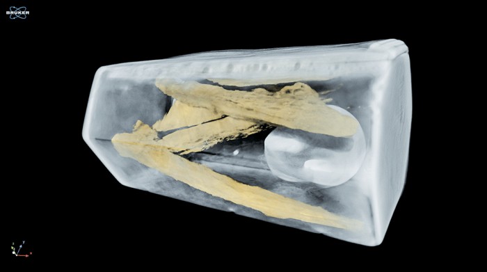 Artifact-Revealed-X-Ray-Scan