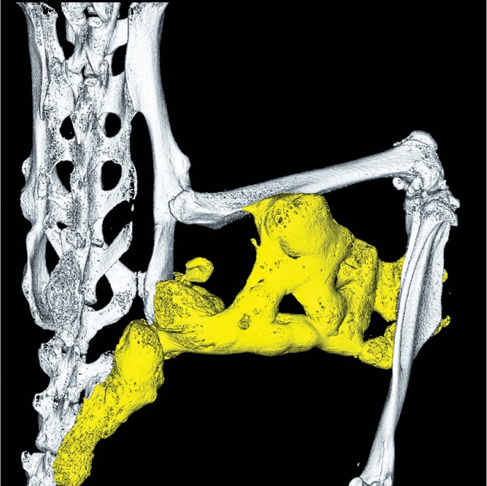 Antibody-Treats-Rare-Bone-Disorder