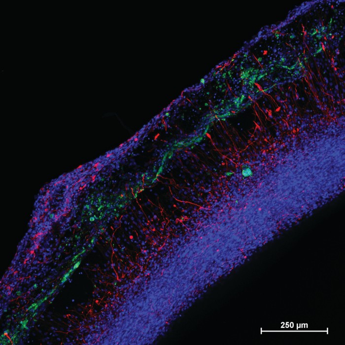 Stem-Cell-Derived-Brain-Mimics Stem-Cell-Derived-Brain-Mimics