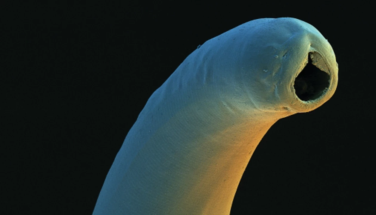 Asthma patients could stop wheezing thanks to worm spit
