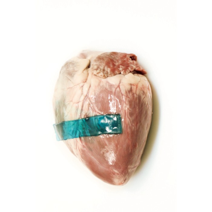 Slug-mucus-inspires-possible-surgical