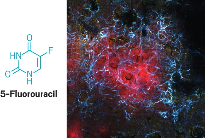 Cancer-tissue-stiffness-helps-target