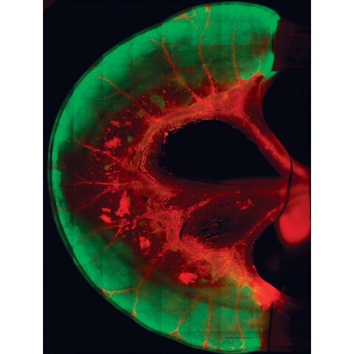 Intestinal-grafts-grown-stem-cells