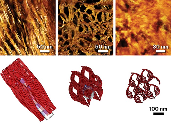 Bone nanostructure revealed by electron microscopy