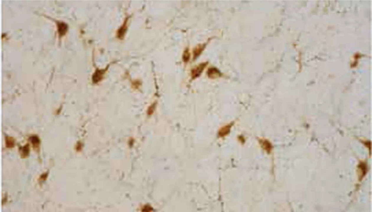 Non-addictive opiate-like compounds may help treat narcolepsy