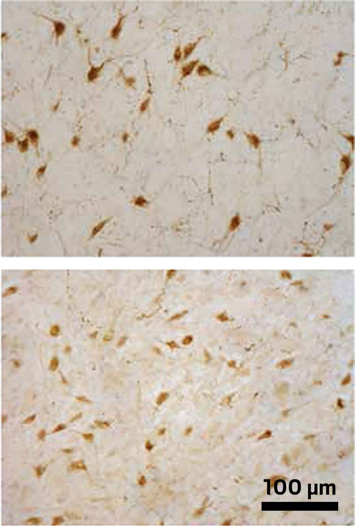 Non-addictive opiate-like compounds may help treat narcolepsy﻿