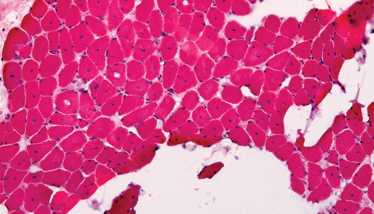 Dynacure launches with $55 million and Ionis antisense oligonucleotide drug