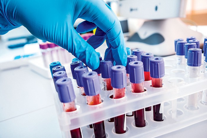 Blood-tests-fingertips
