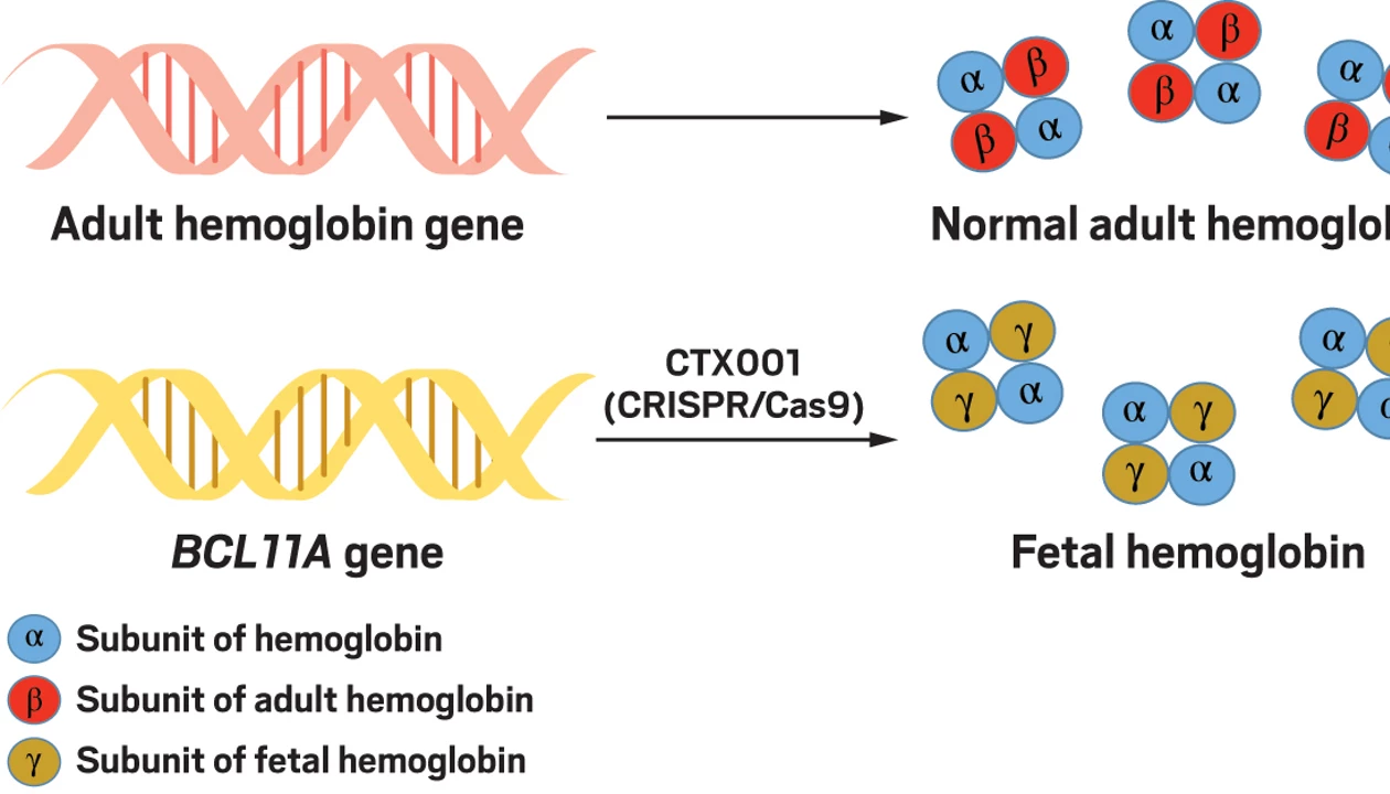 CRISPR gene editing in humans appears safe, and potentially effective