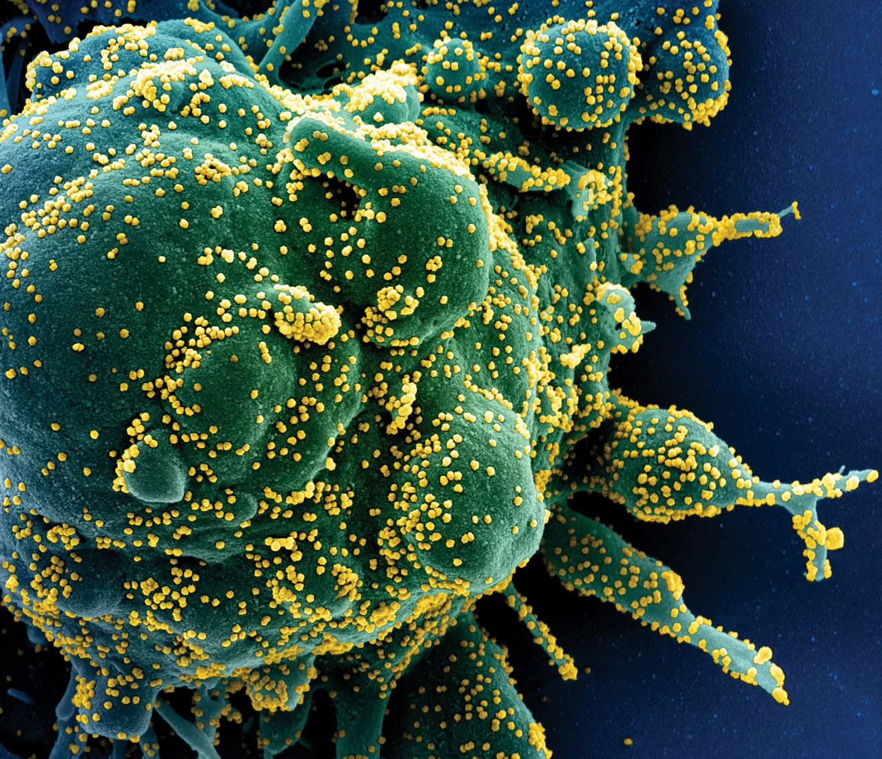 Coronavirus puts science to the test