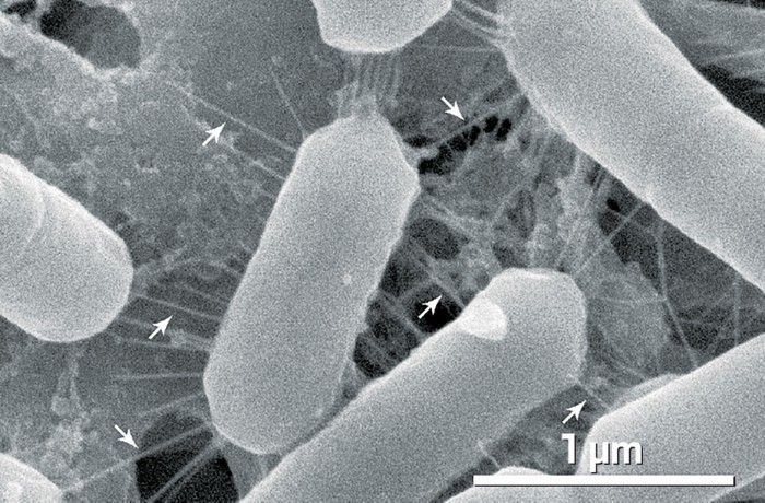 Bacteria find a niche in your nose
