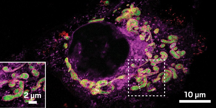 Extending the reach of expansion microscopy