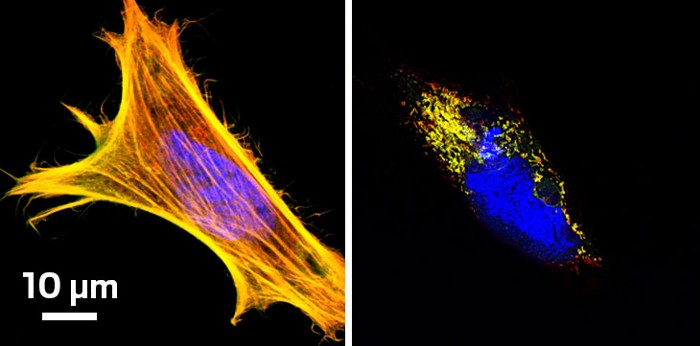 Photoactivated click-chemistry reaction shows inner lives of cells