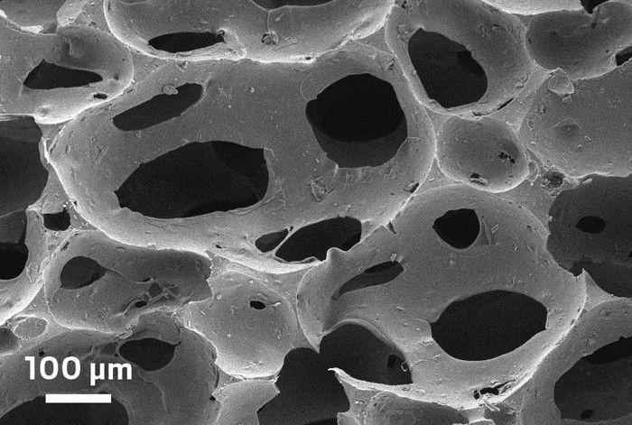 Low-cost biodegradable foam could heal chronic wounds