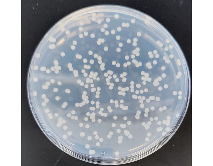 Methane-eating bacteria could one day slow global warming