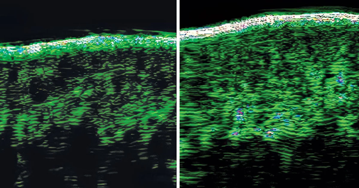 The world’s first antiaging probiotic from the world’s largest chemical ...
