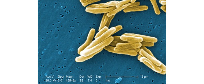 Solving-Mystery-Sugar-Chain-Growth