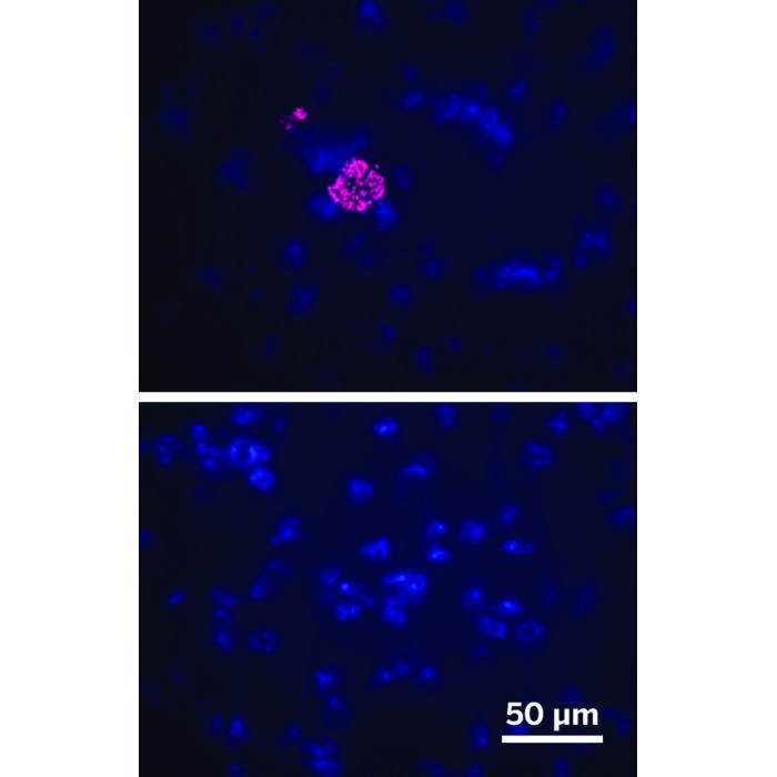 Lowering-Brains-Drawbridge