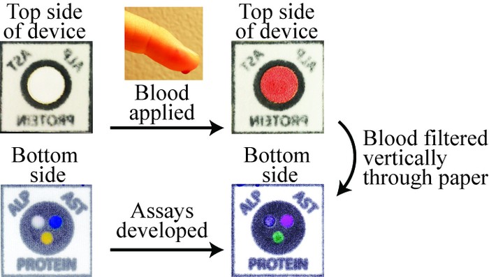Paper-Device-Monitors-Liver-Health