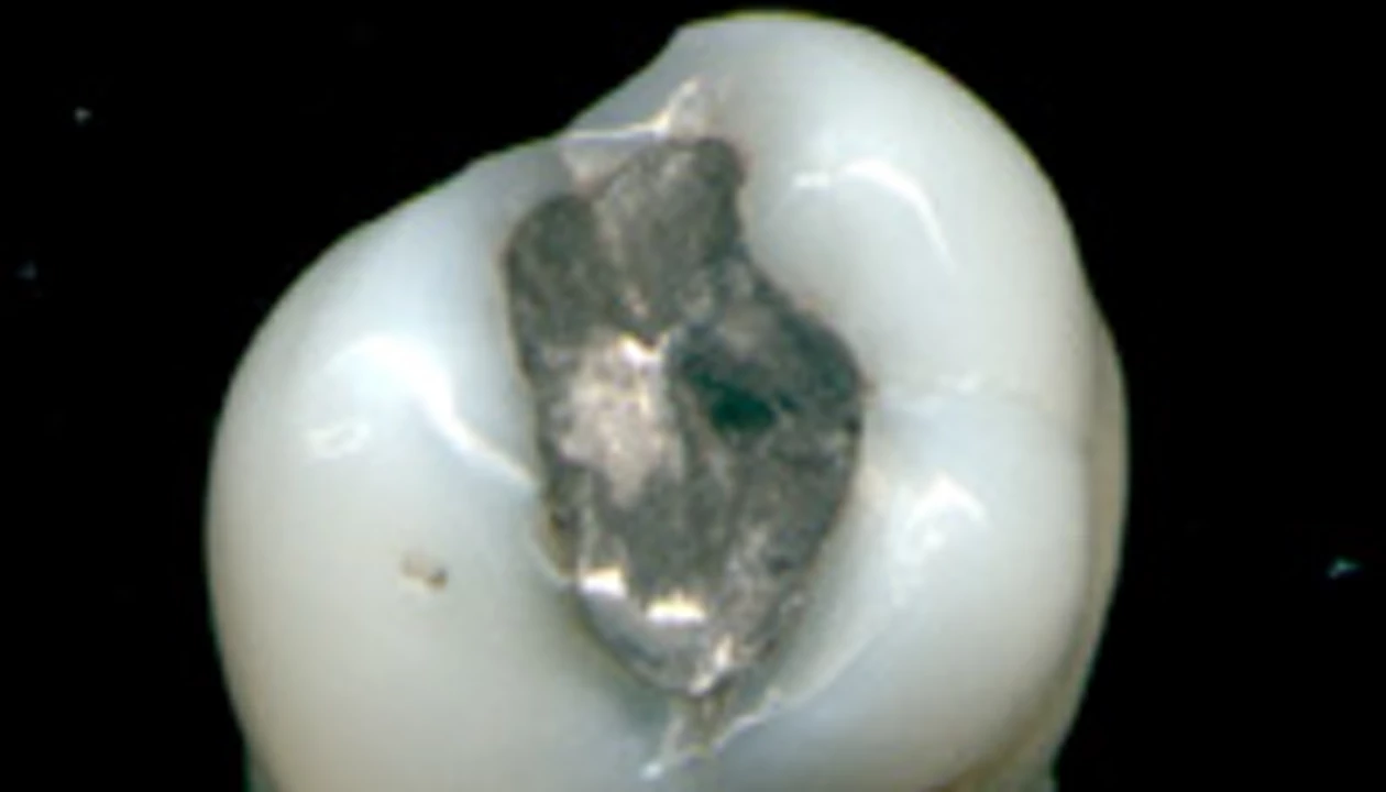 Isotope Fingerprints Help Researchers Pinpoint Source Of People’s ...