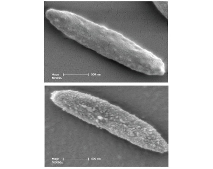 New-Antibiotic-Disrupts-Resistant-Superbugs