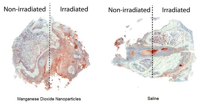 Manganese-Dioxide-Nanoparticles-Increase-Tumor