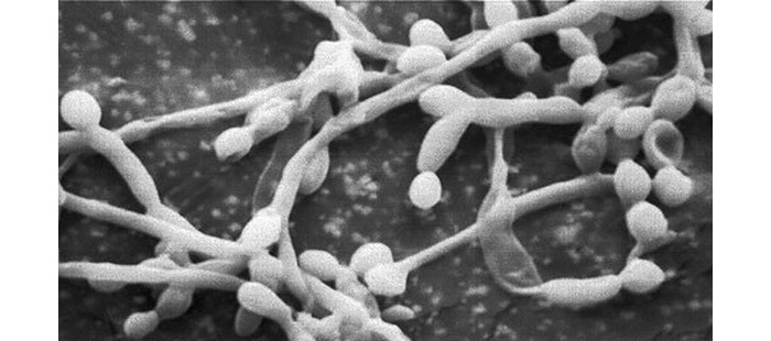 Coating-Medical-Devices-Kills-Fungi
