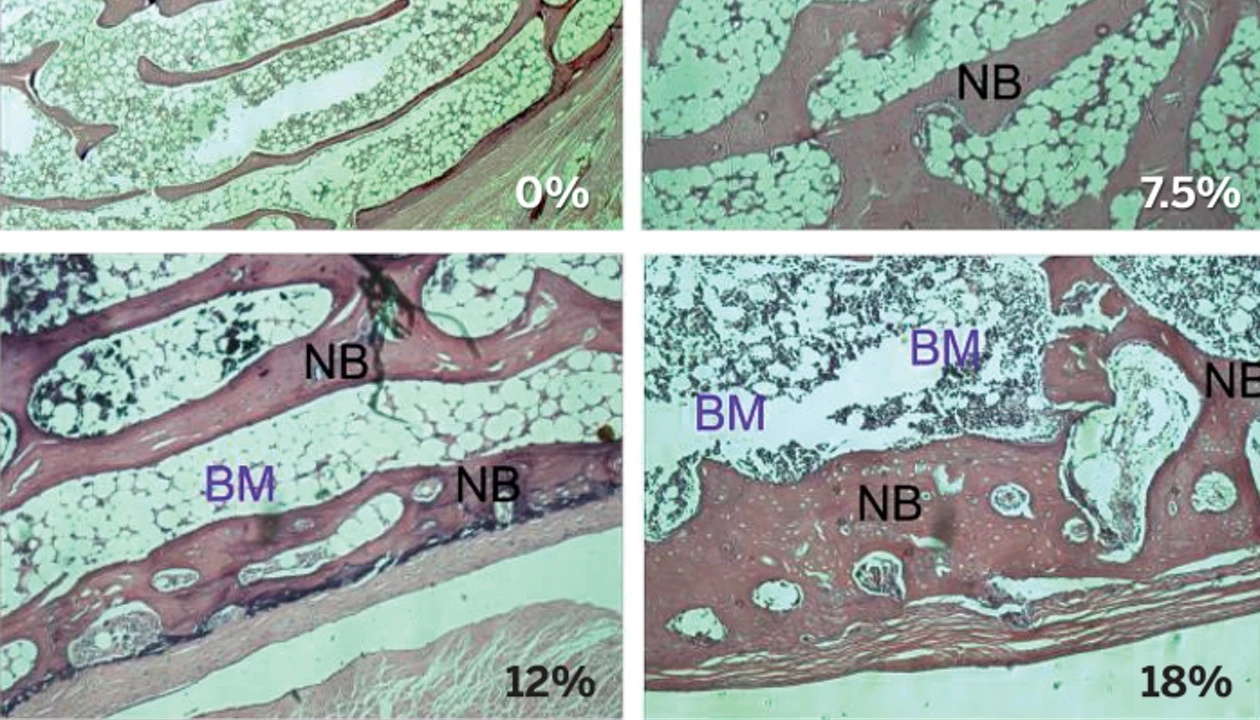 Oyster Shell Helps Heal Bone Defects