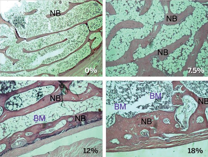 Oyster-Shell-Helps-Heal-Bone