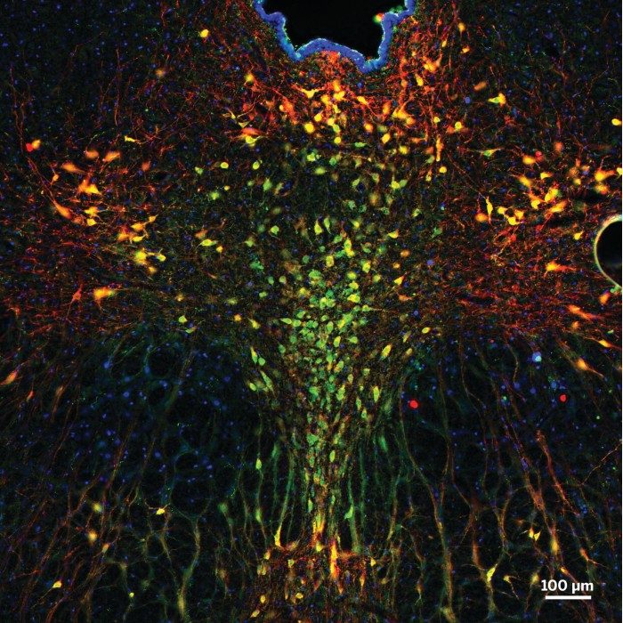 Close-Look-Rat-Brains-Under