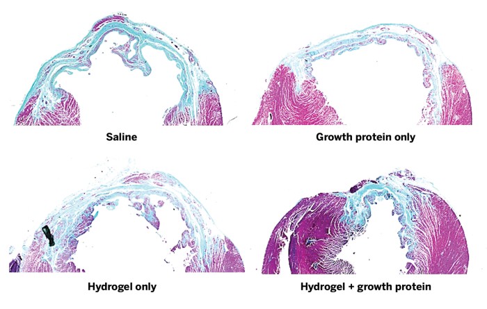 Repairing-Heart-Protein-Hydrogel-Combo