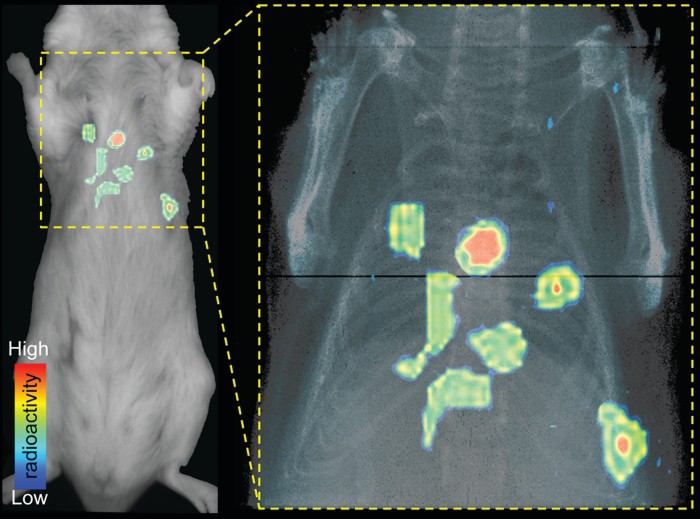 Nanoparticles-Hit-Cancers-Moving-Target
