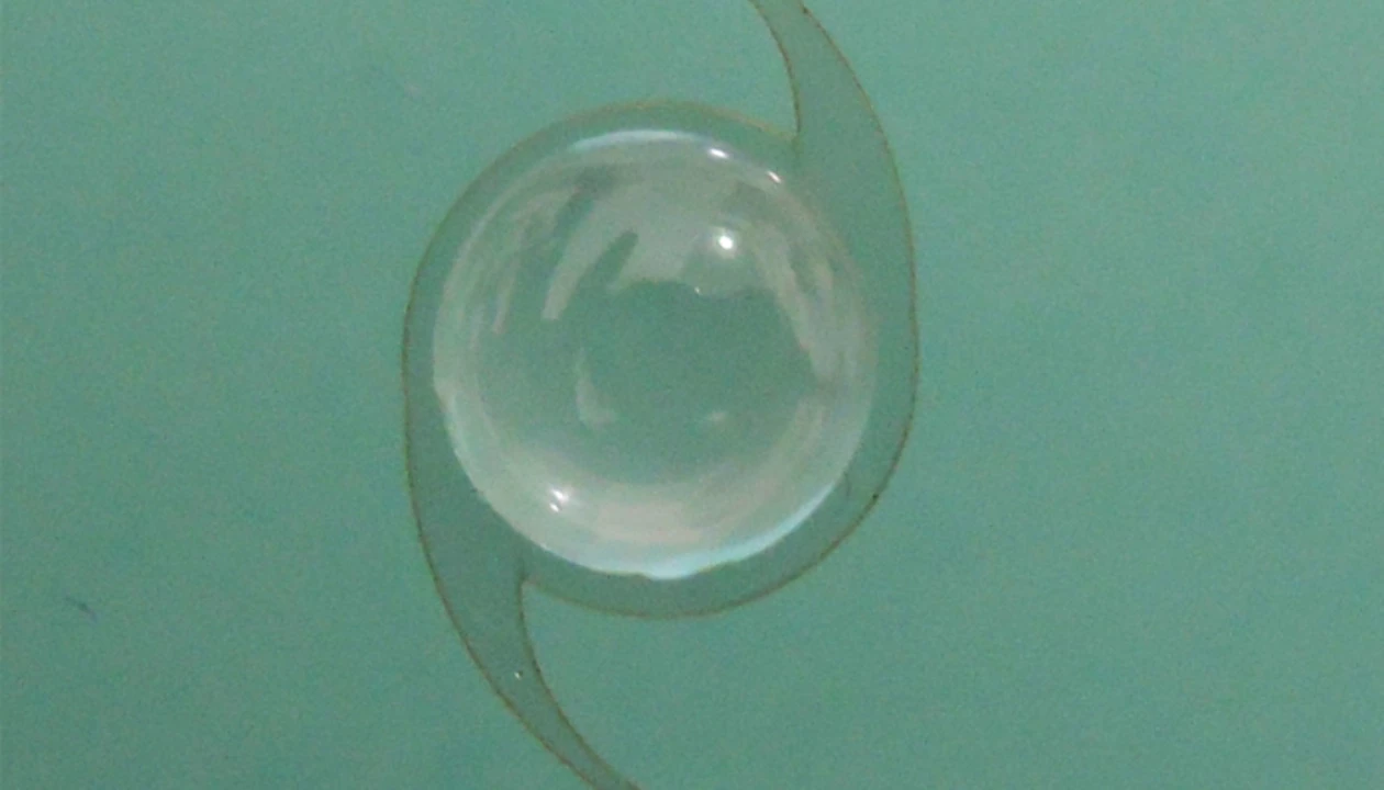 A Liquid Lens Could Improve Cataract Treatment