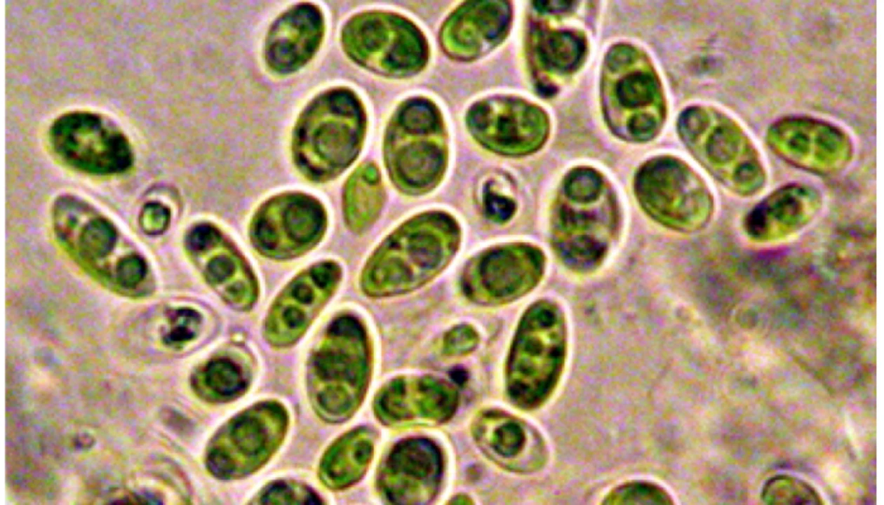 Algae Can Carry A Silver Lining