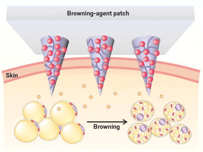 Microneedle-skin-patch-fights-fat