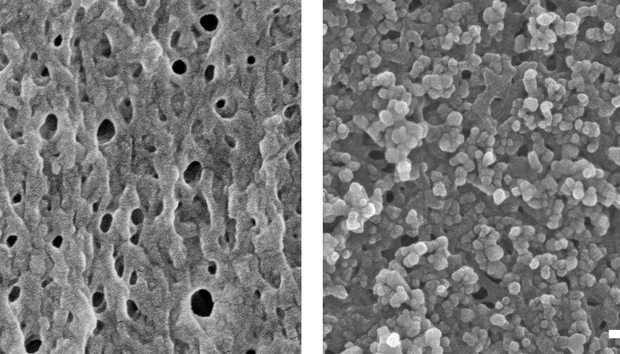 Membrane knocks out antibiotic-resistant bacteria