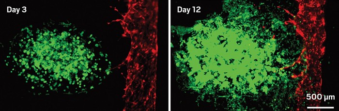 3-D printing creates more realistic tumor models