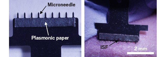 Prototype diagnostic patch picks up on a chemical below the skin
