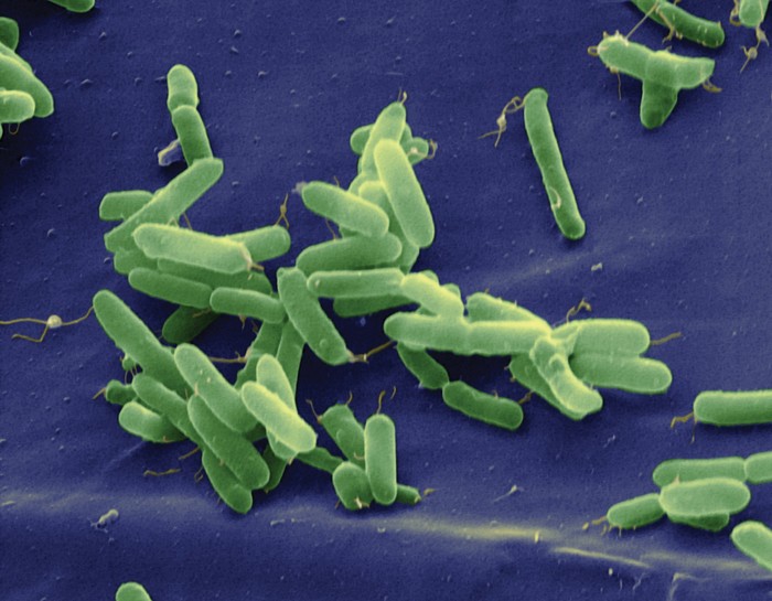 The first infection diagnostic emerges from Carb-X