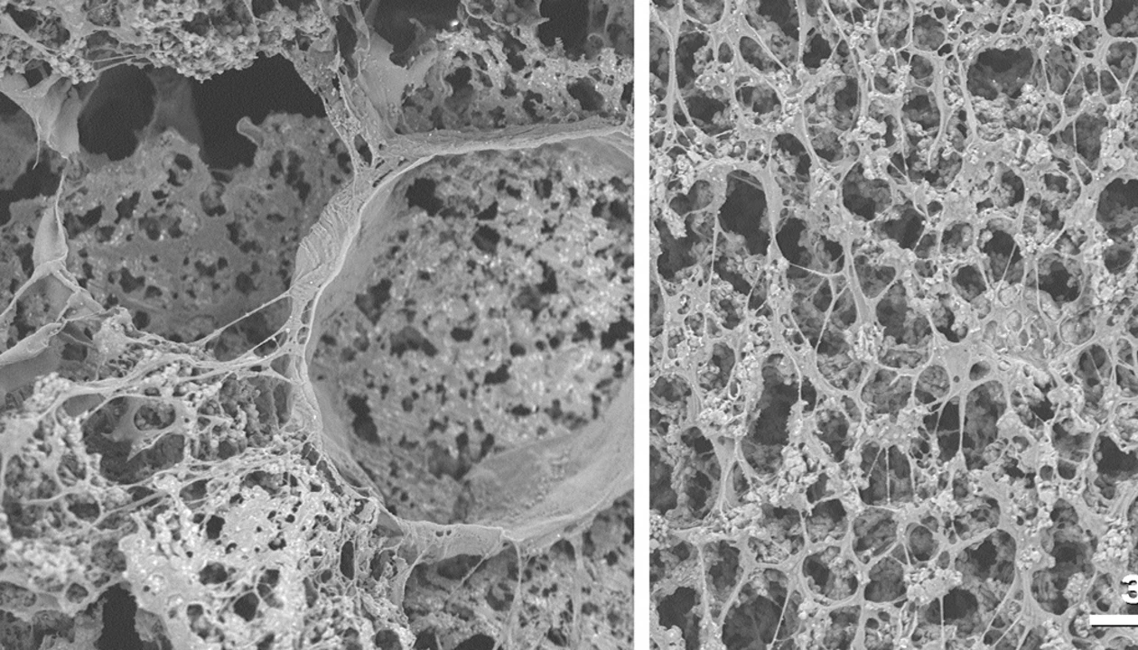 Magnetic bone scaffolds can help speed bone cell growth