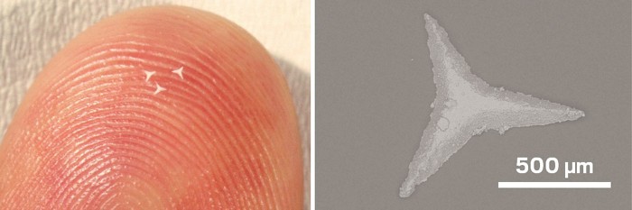 Star-shaped particles ferry medicine through the skin’s barrier